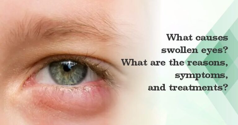 What causes swollen eyes? What are the reasons, symptoms, and ...